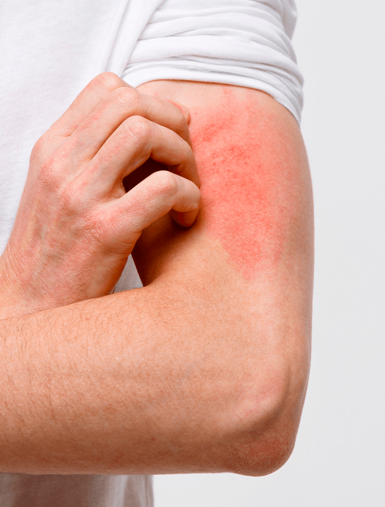 Dermatología Clínica - Clínica Dermatológica Isela Méndez